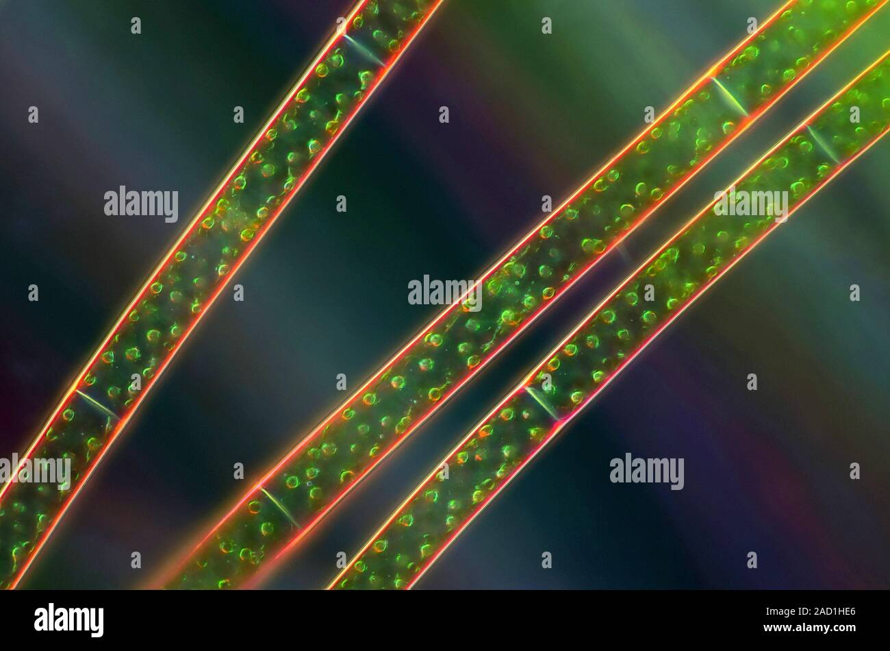 Spirogyra algae. Polarised darkfield illuminated light micrograph of ...