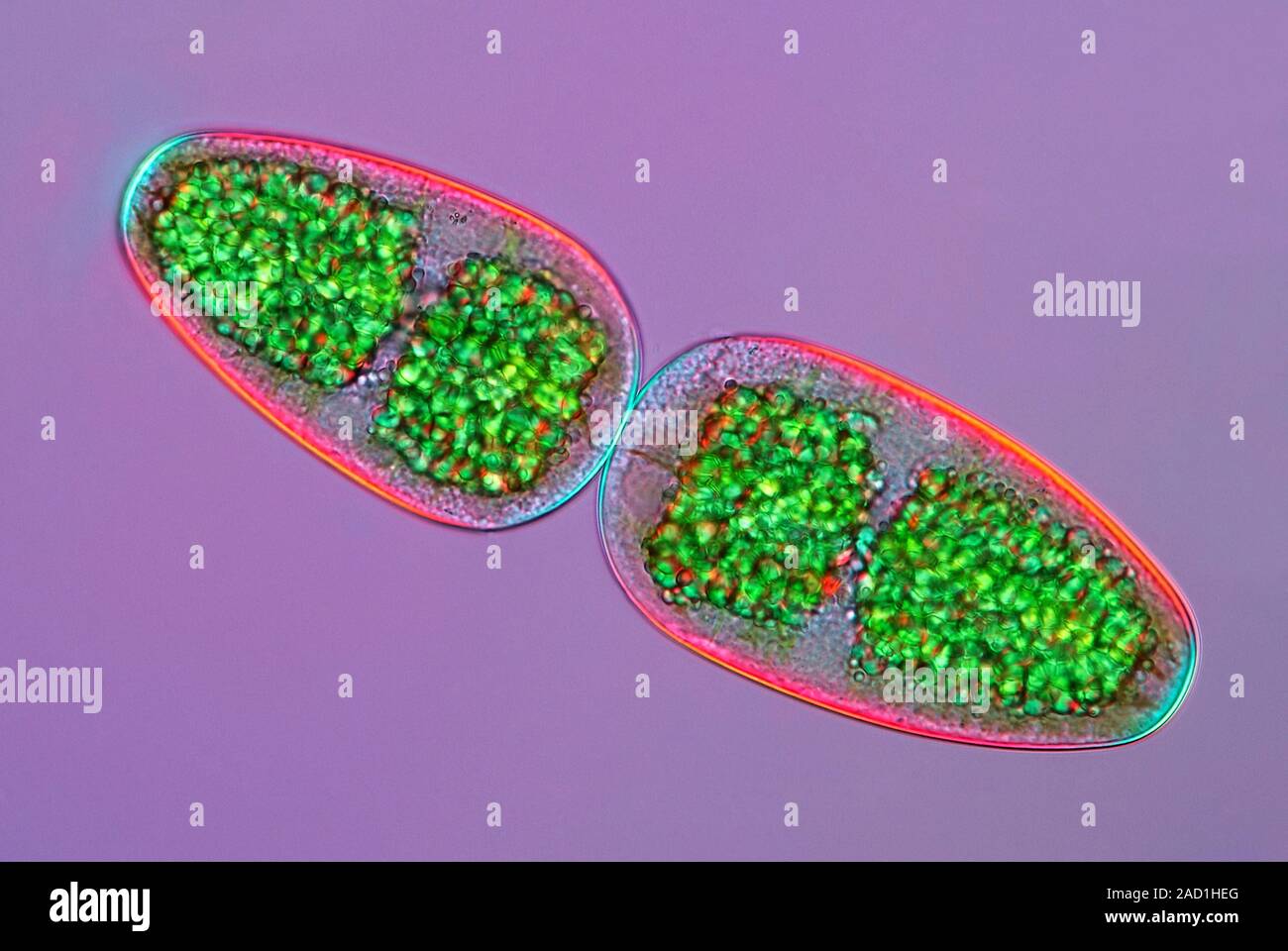 Netrium desmid. Polarised light micrograph of a Netrium sp. desmid ...