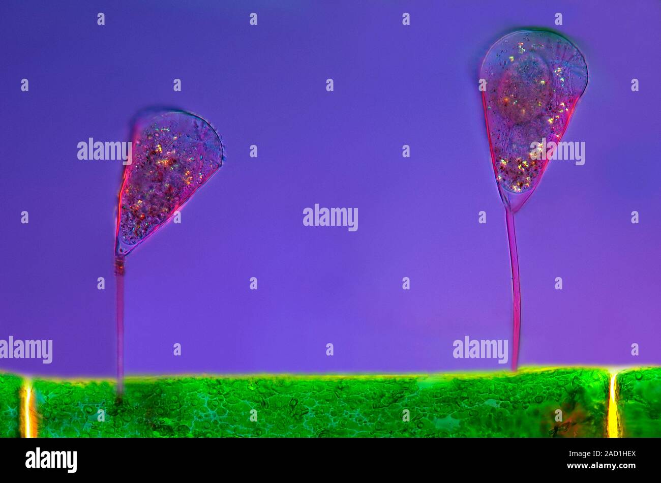 Suctoria on green algae. Polarised light micrograph of Suctoria sp ...