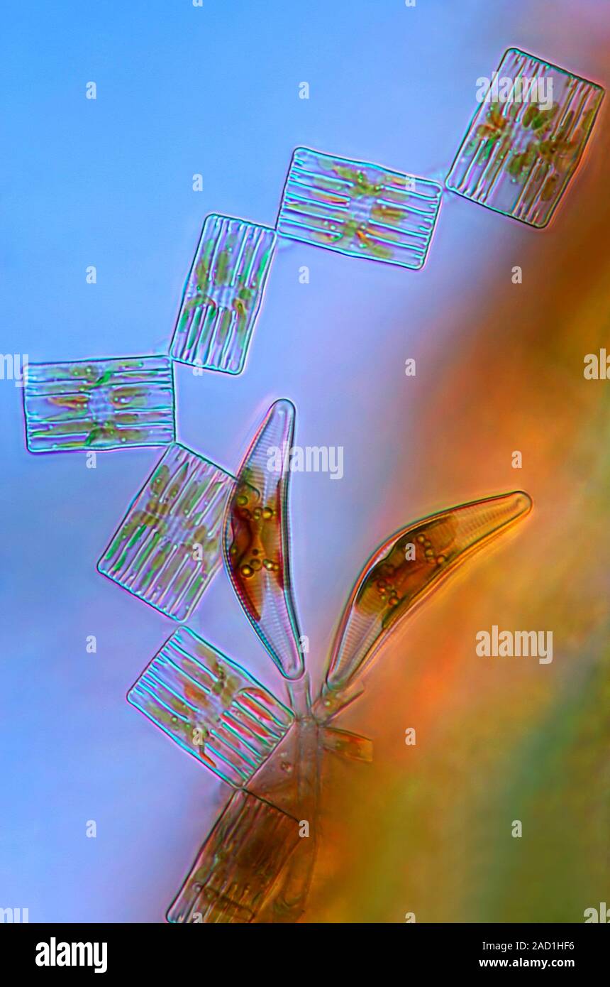 Diatoms. Polarised light micrograph of Cymbella sp. (oval) and ...
