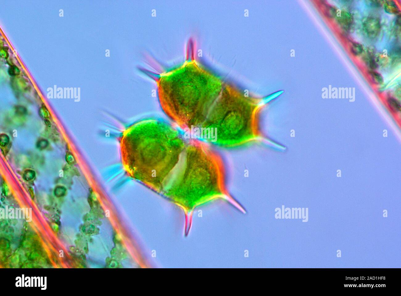 Xanthidium desmid. Polarised light micrograph of a Xanthidium sp ...
