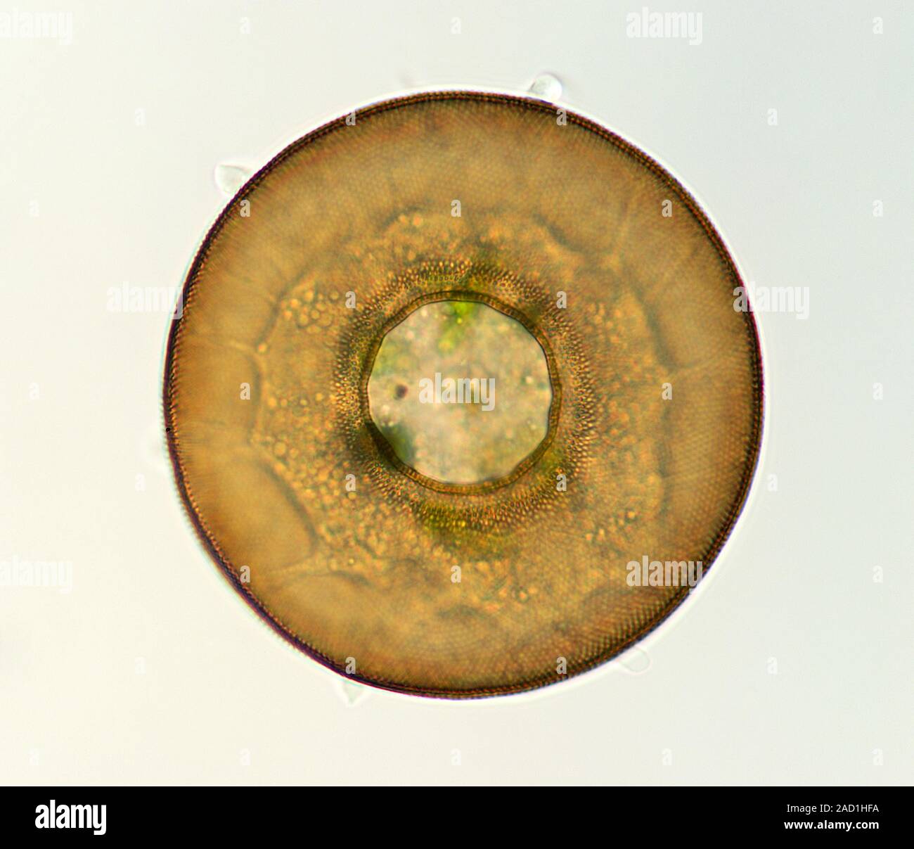 Shelled amoeba. Polarised light micrograph of an Arcella sp. testate ...