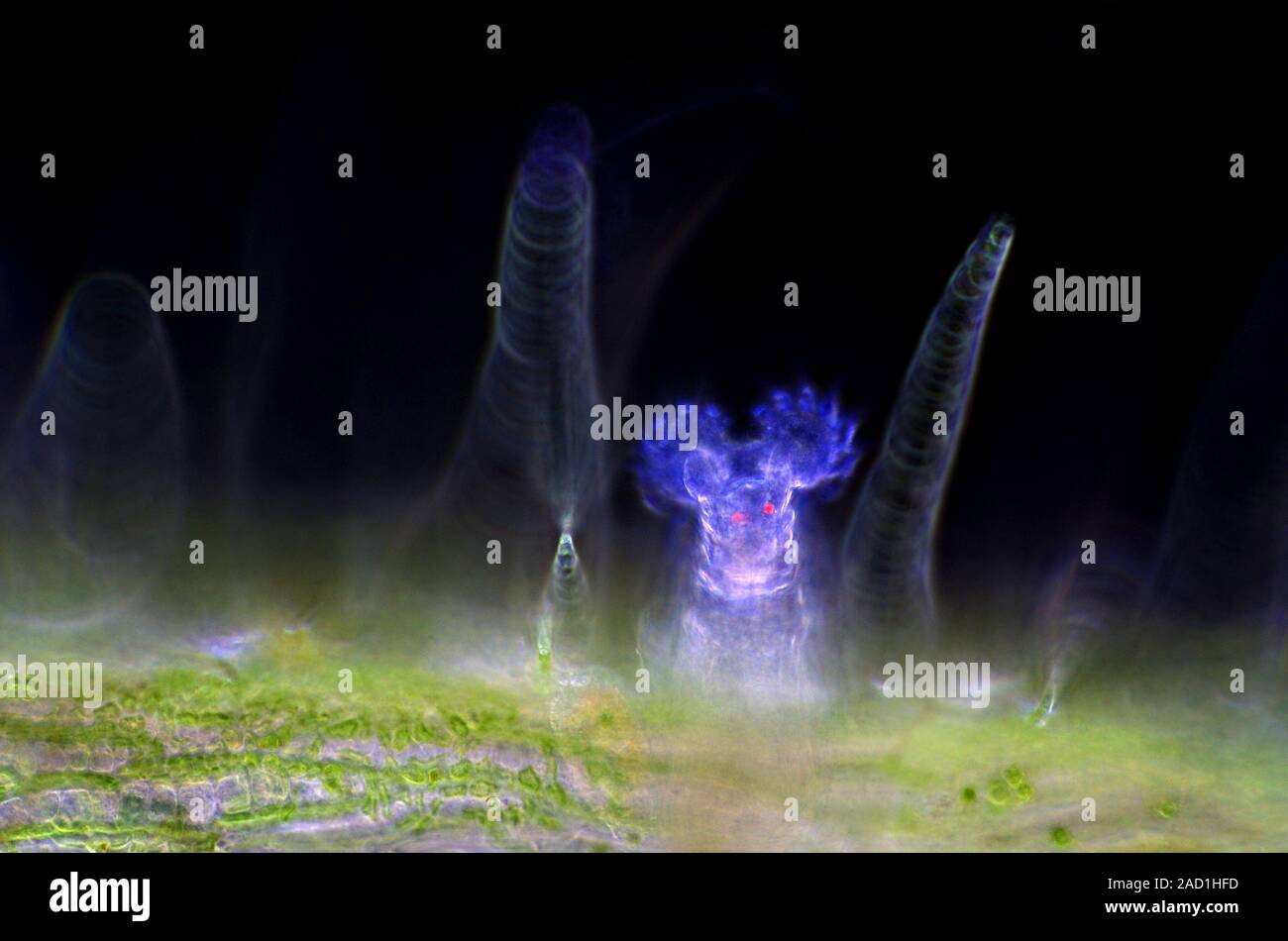 Philodina rotifer. Darkfield illuminated light micrograph of a ...