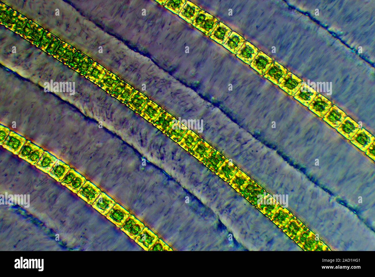 Hyalotheca desmid. Phase contrast light micrograph of Hyalotheca sp ...
