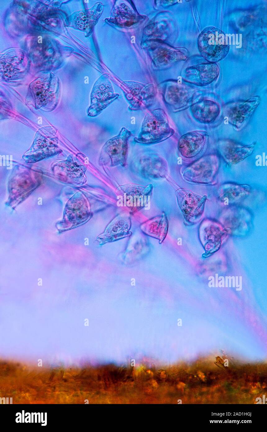 Carchesium colony. Polarised light micrograph of a colony of Carchesium ...