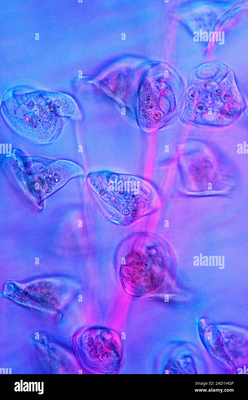 Carchesium colony. Polarised light micrograph of a colony of Carchesium ...