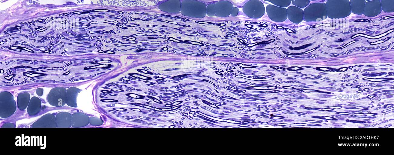 Light microscopy of peripheral nerve fibres in longitudinal section ...