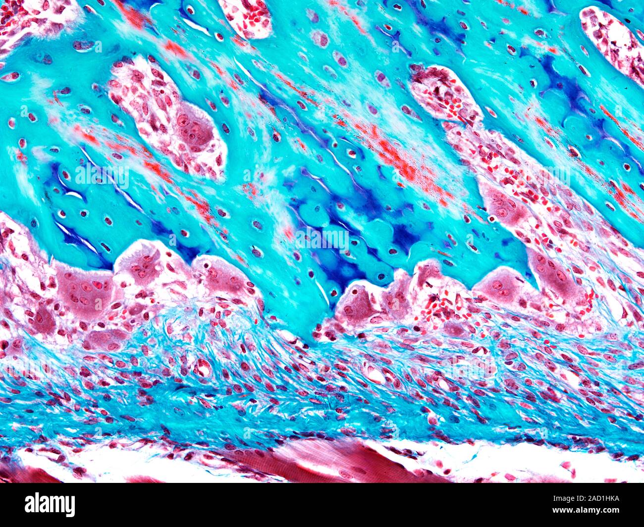 Light microscopy of multinucleated osteoclasts (red) at the surface of ...