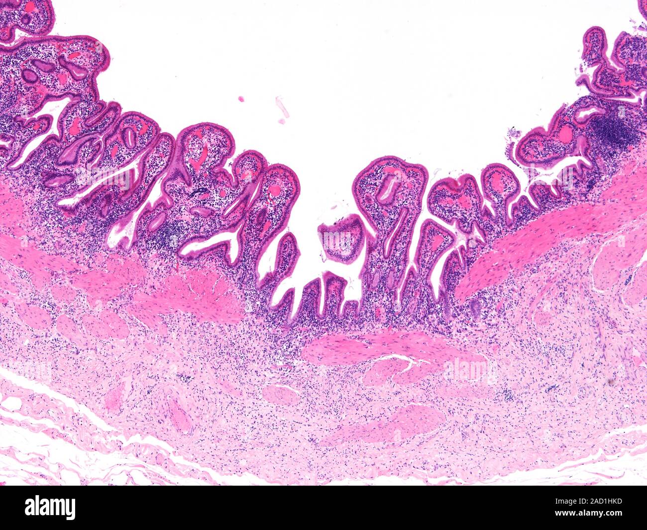 Light microscopy of the internal surface of the gall bladder. The ...