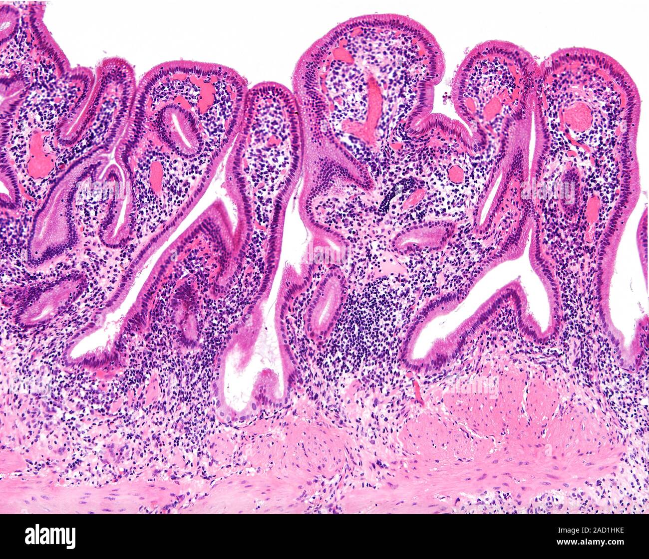 Light microscopy of the internal surface of the gall bladder. The ...
