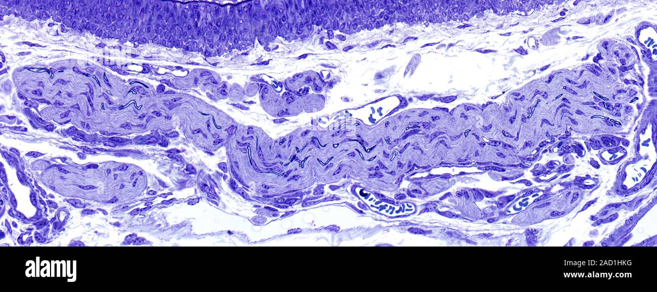Light microscopy of some myelinated and mostly unmyelinated nerves in a ...