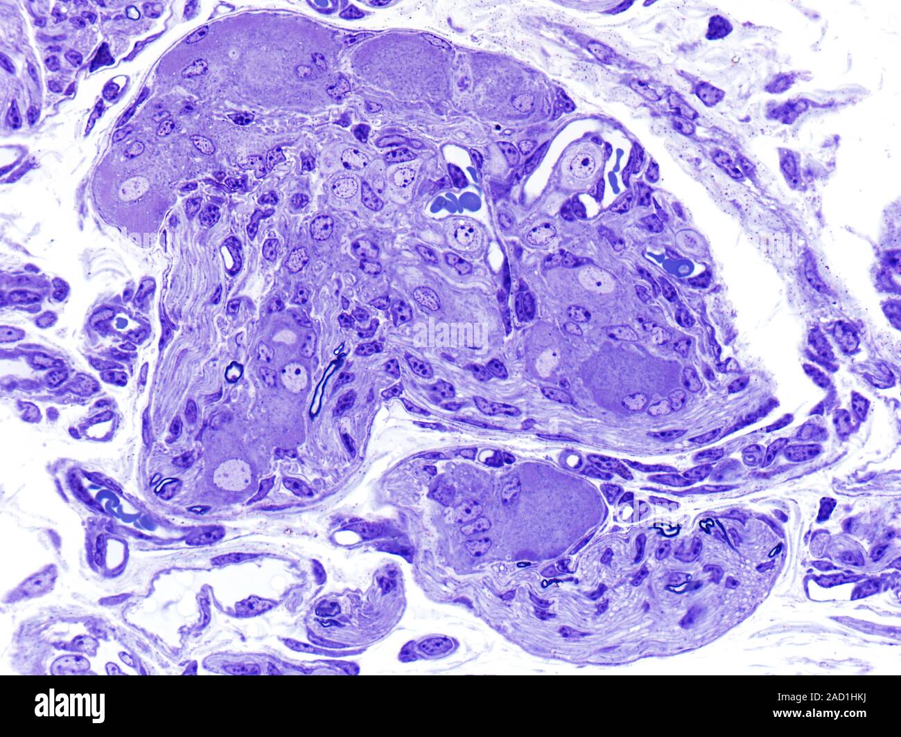 Light microscopy of a nerve ganglion. Peripheral ganglia are clusters ...