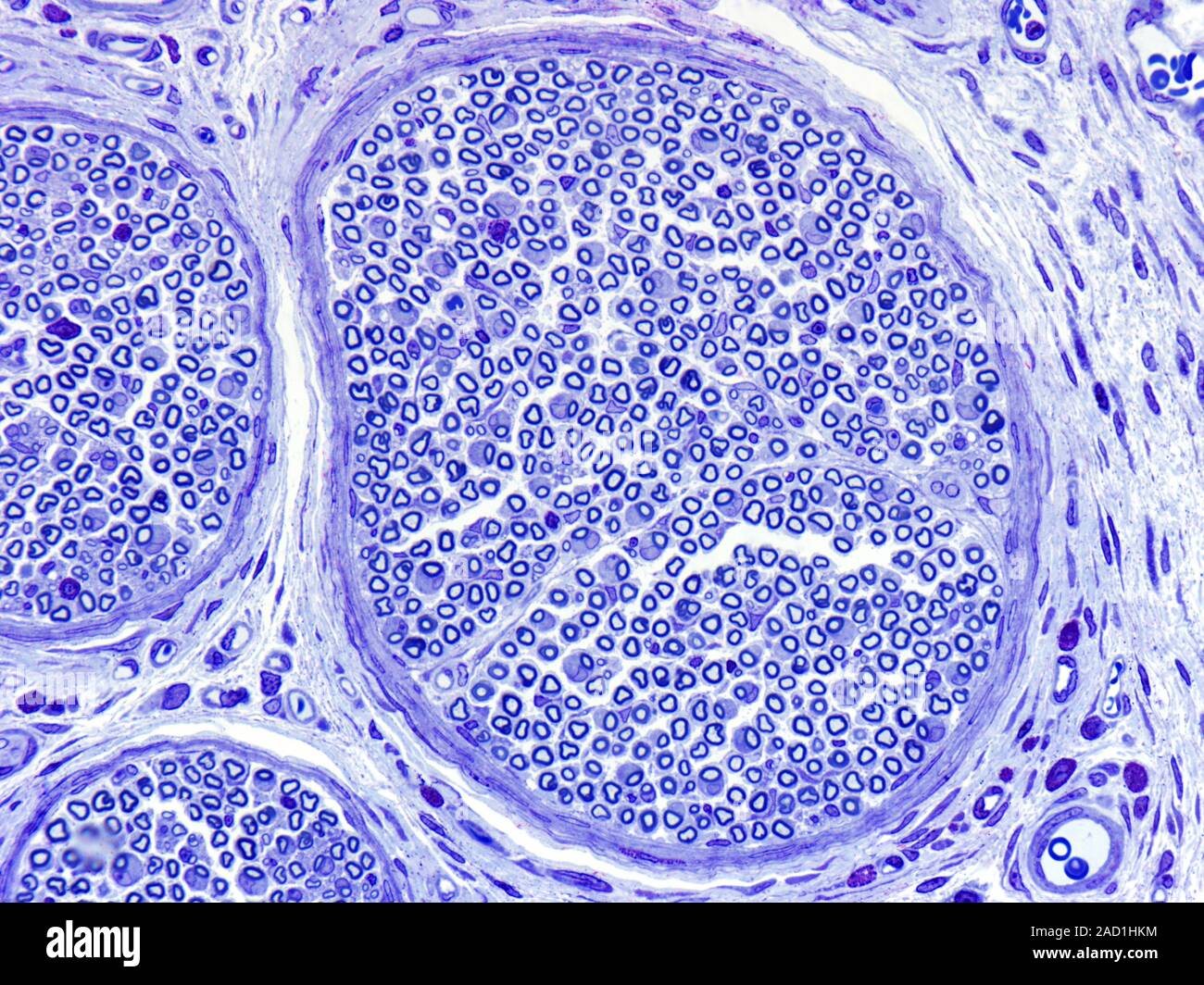 Light microscopy of a cross-sectioned nerve fibre containing myelinated ...
