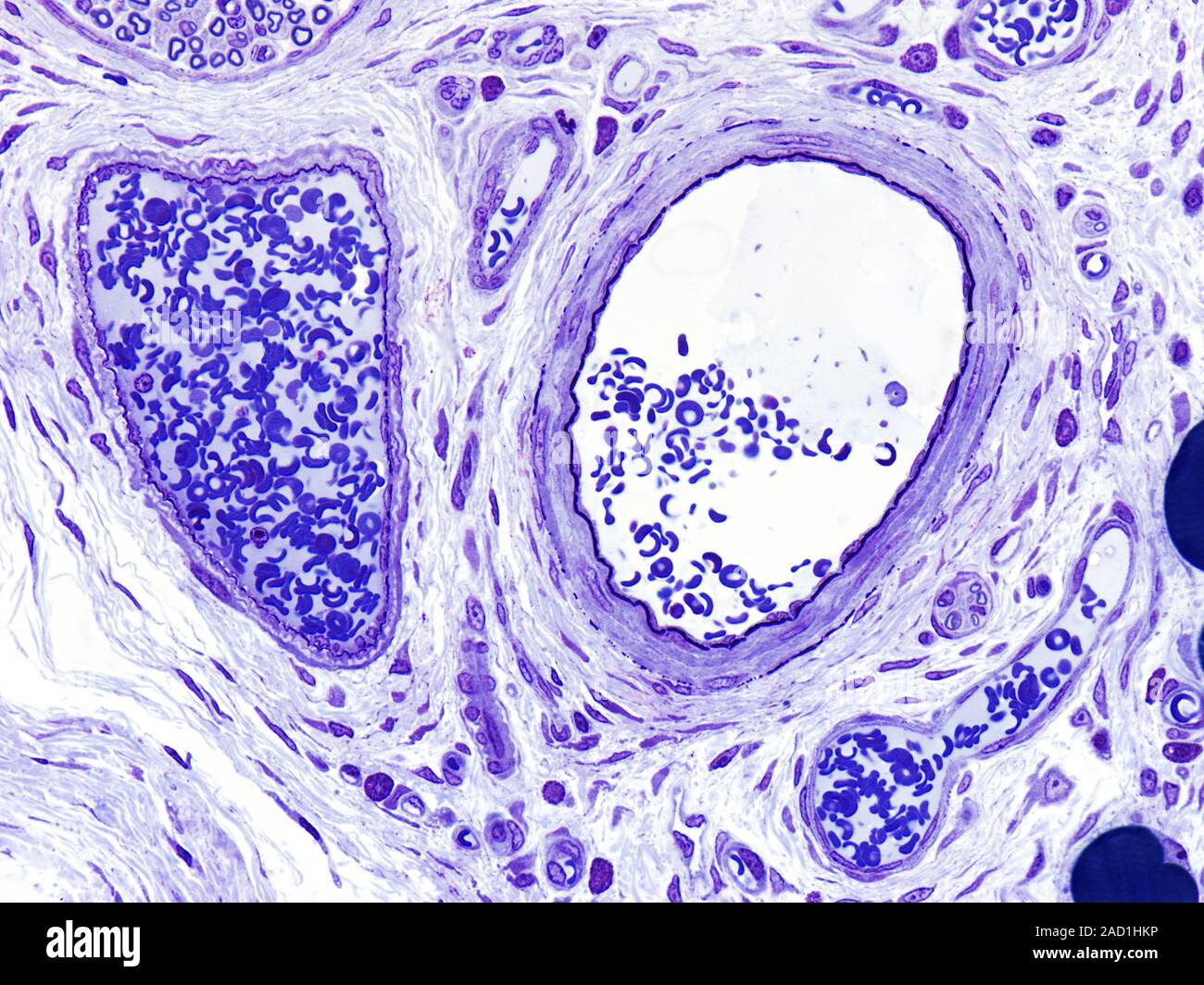 Light microscopy of a vein (left) and artery (right). Veins have ...
