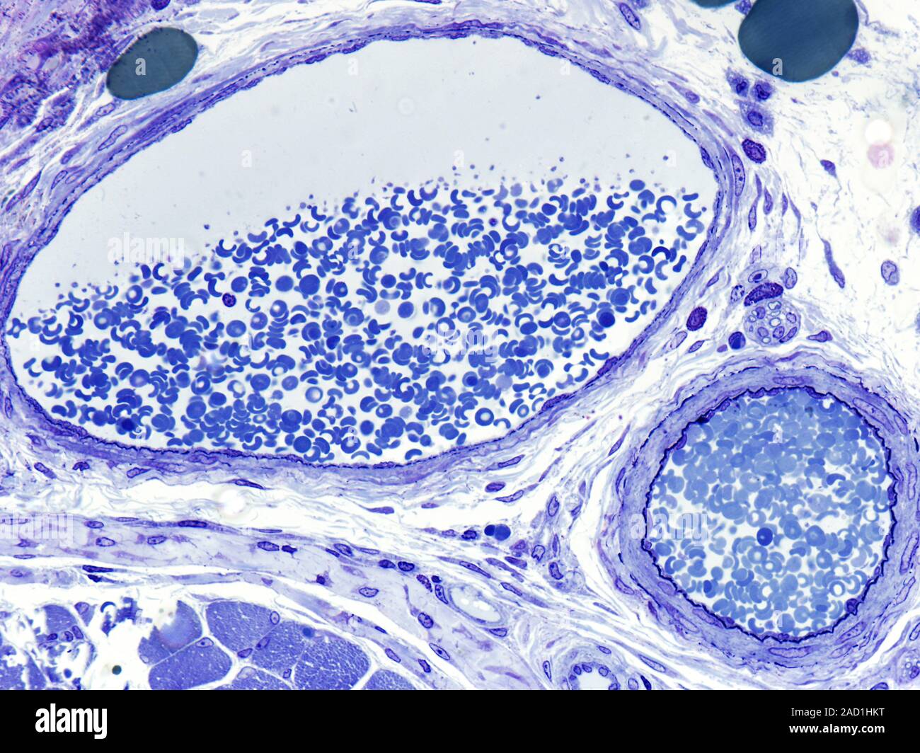 Light microscopy of a vein (left) and smaller artery (right). Veins ...