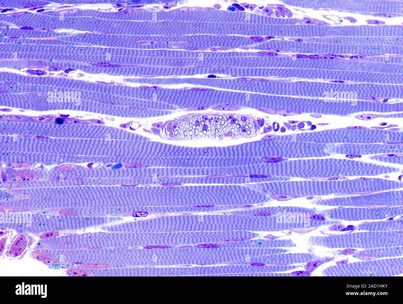 Light microscopy of skeletal muscle fibres seen in longitudinal section. The alternating banding ...