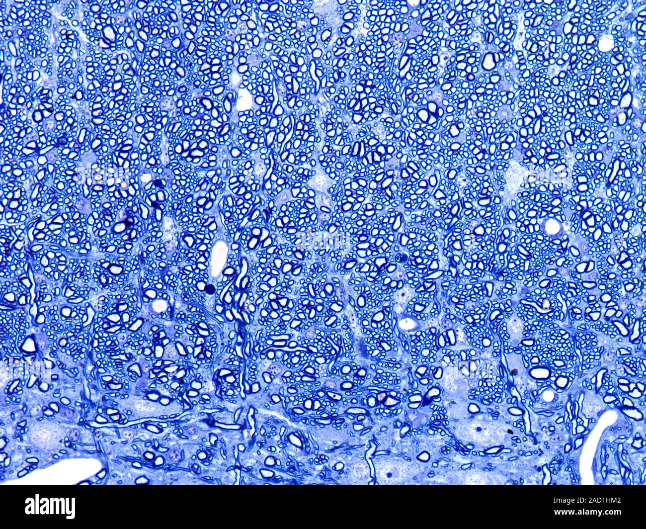 Light microscopy of white matter of the brain. White matter is ...