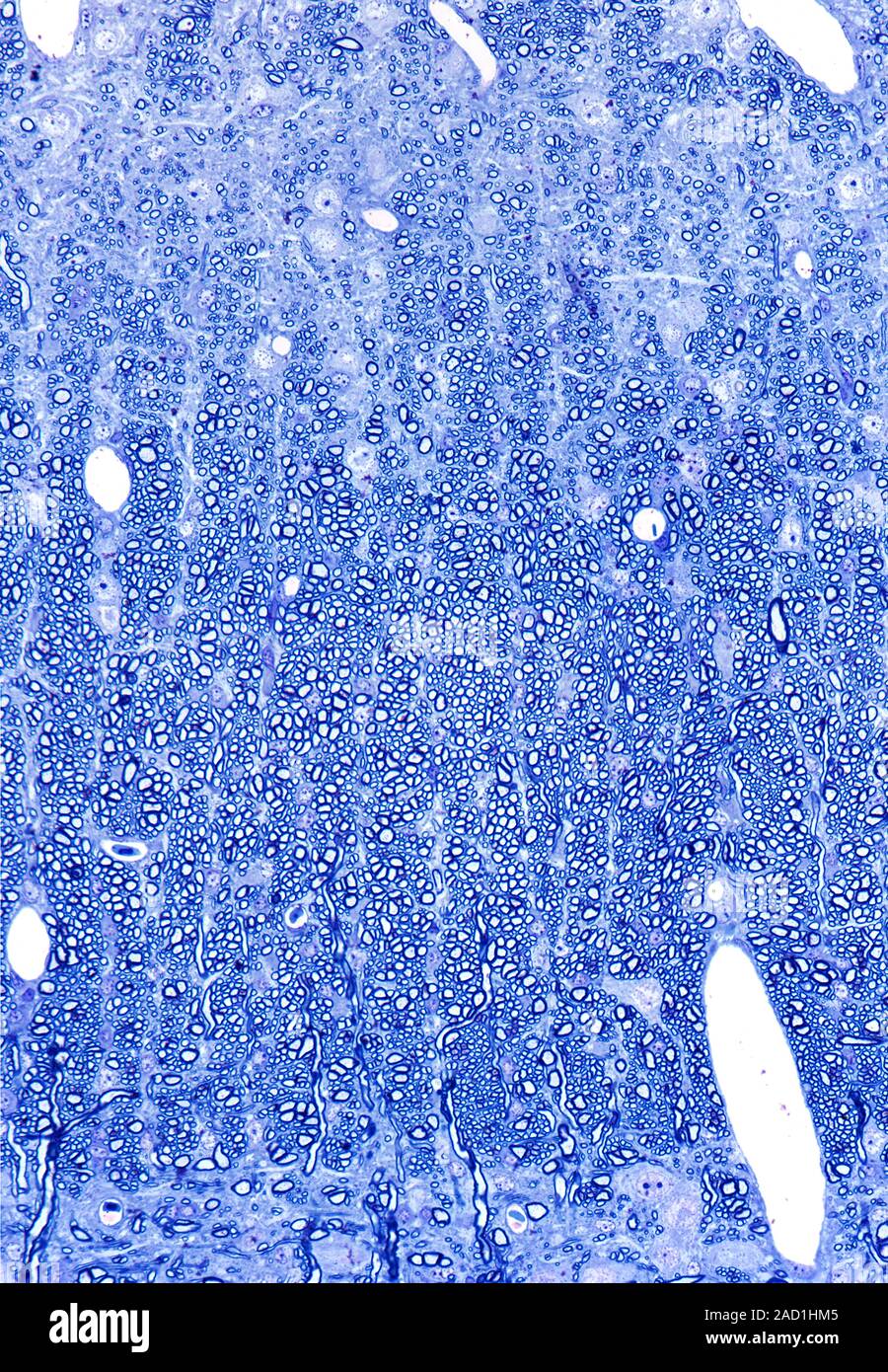 Light microscopy of white matter of the brain. White matter is ...