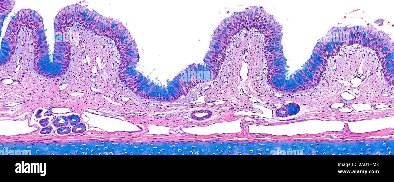Light microscopy of the trachea. The inner lining consists of a so ...