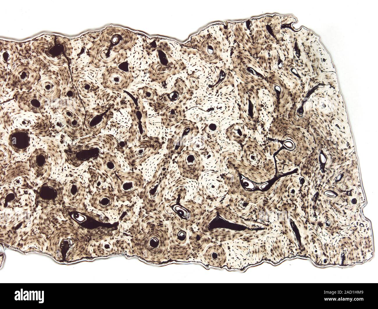 Light microscopy of compact bone in an unstained ground section. The ...