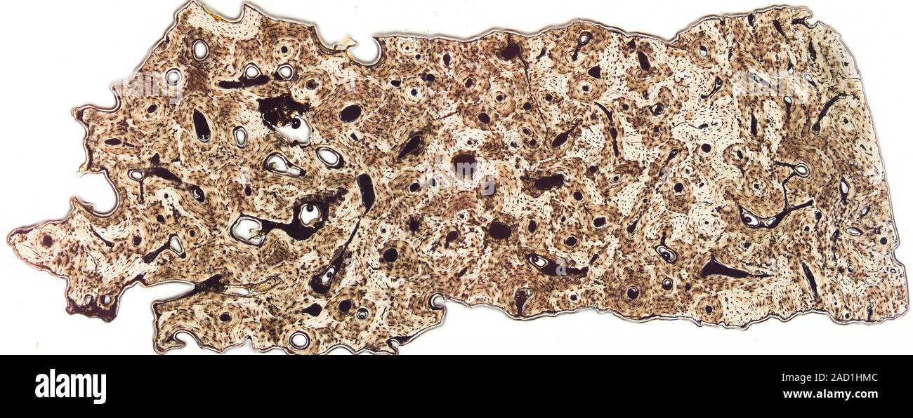 Light Microscopy Of Compact Bone In An Unstained Ground Section The Minute Nuclei Are