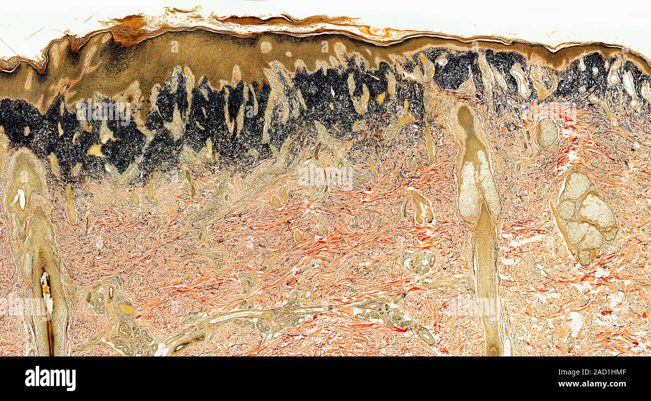 Light microscopy of human skin. Black stained material is elastic ...