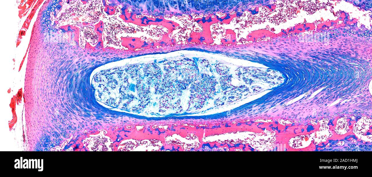 Light microscopy of an intervertebral disc. The disc is found between ...