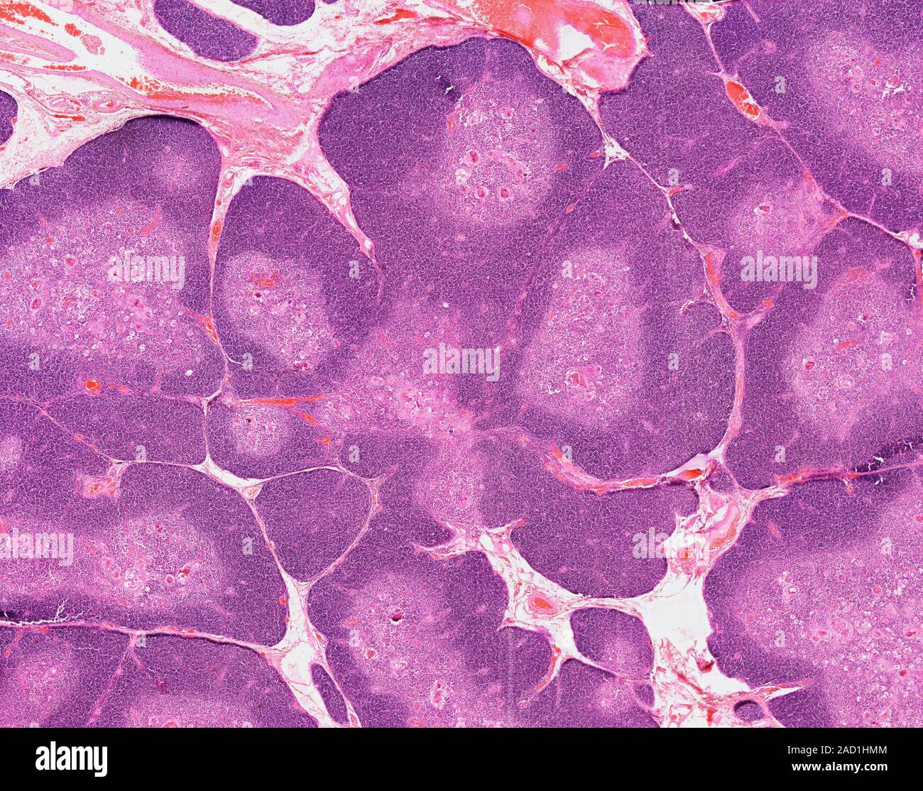 Light microscopy of the thymus gland displaying a lobular morphology ...