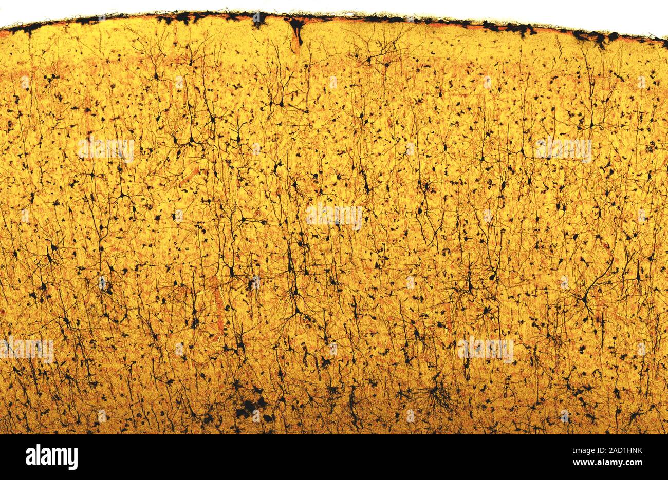 Light microscopy of the brain showing the superficial part of the ...