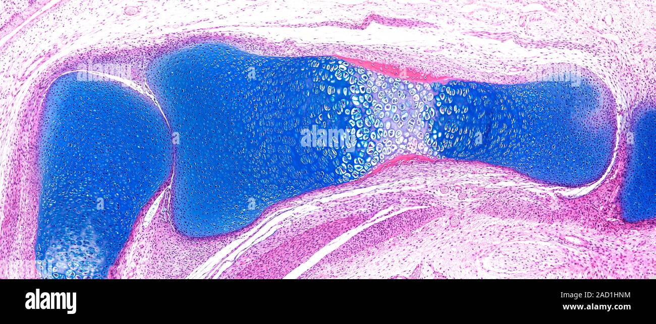 Light microscopy of a fetal finger bone. At this time of development ...
