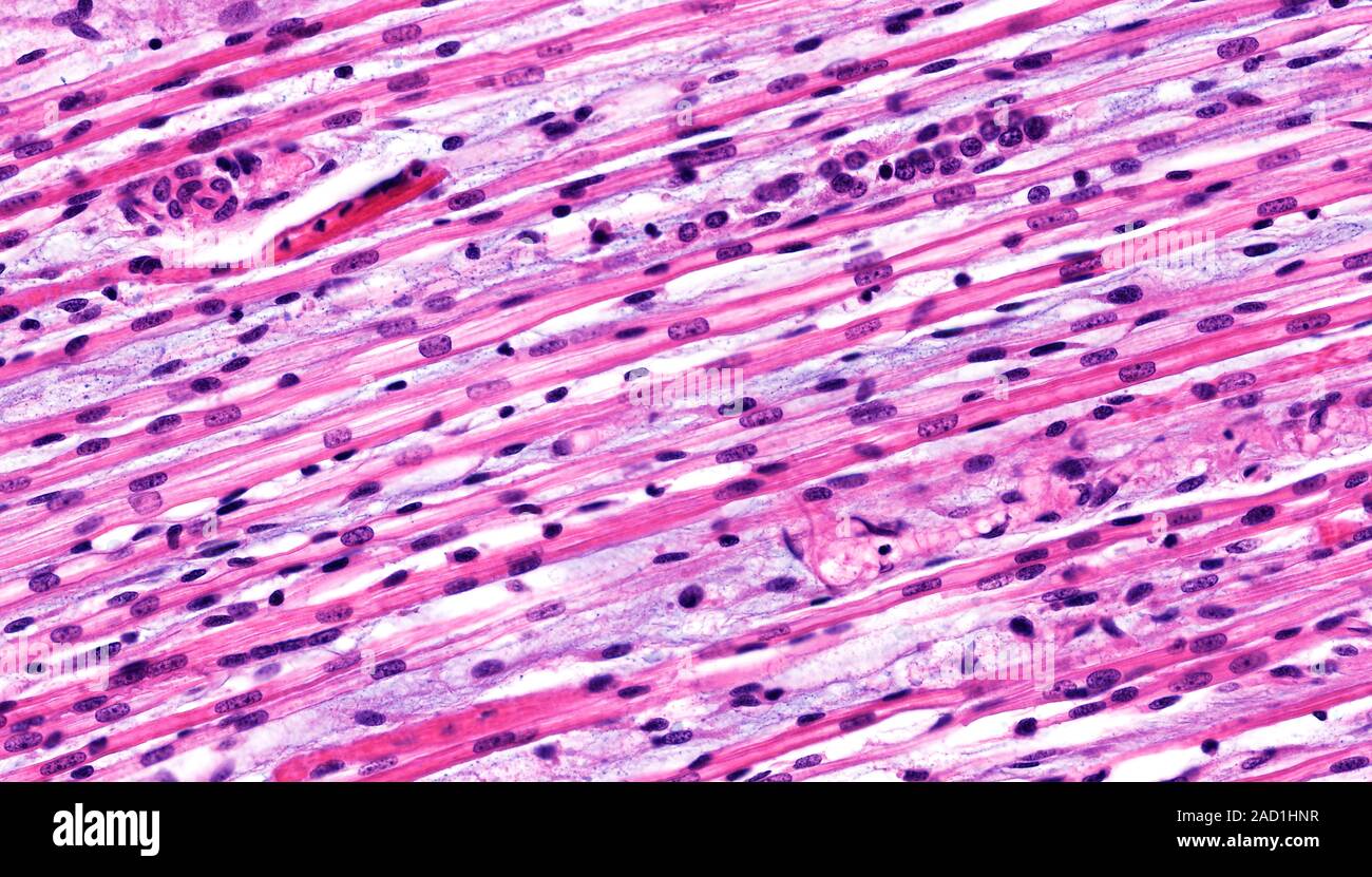 Light microscopy of developing skeletal muscle fibres in the fetus ...