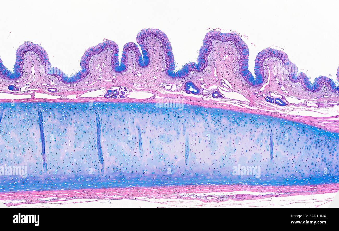 Light microscopy of the trachea. The inner lining consists of a so ...