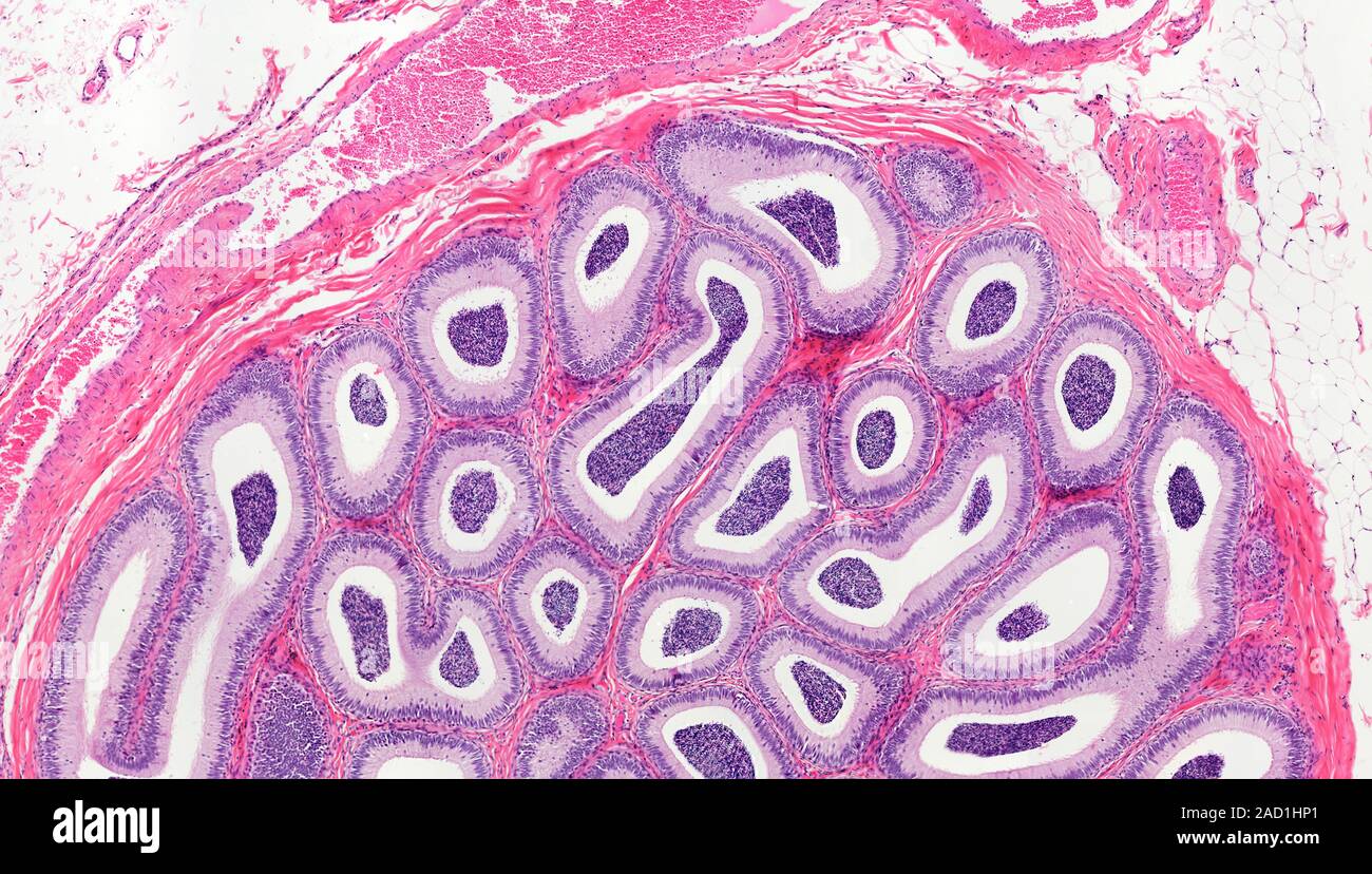 Light microscopy of the epididymis which is a single but highly coiled ...