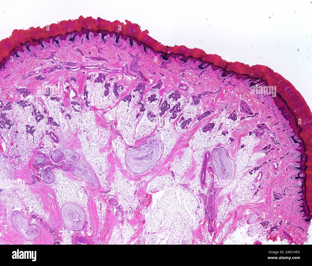 Light microscopy of human skin showing several Pacinian corpuscles ...