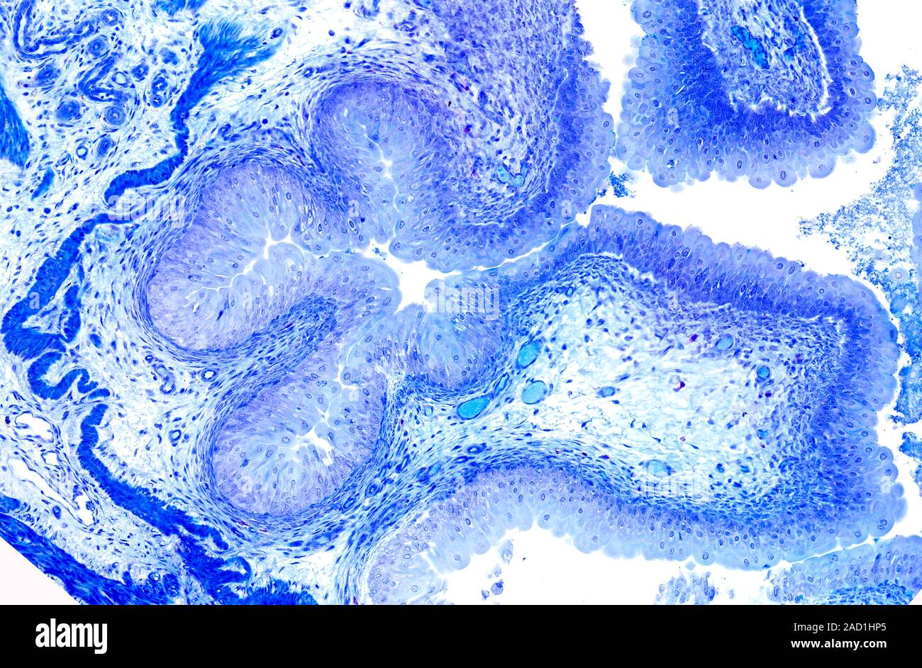 Light microscopy of the internal lining of the urinary bladder. The ...