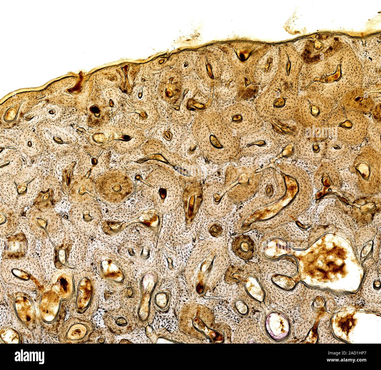 Light microscopy of a thick (approx. 50 m) unstained section of mature ...