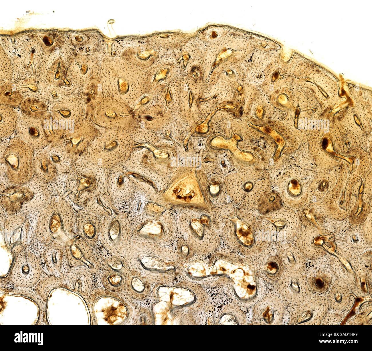 Light microscopy of a thick (approx. 50 m) unstained section of mature ...