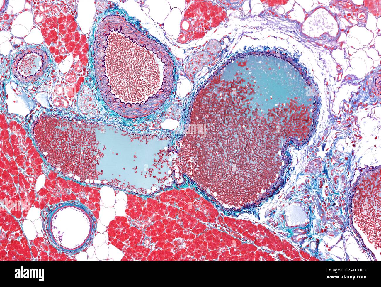 Light microscopy of a small muscular artery (upper left centre) and a ...