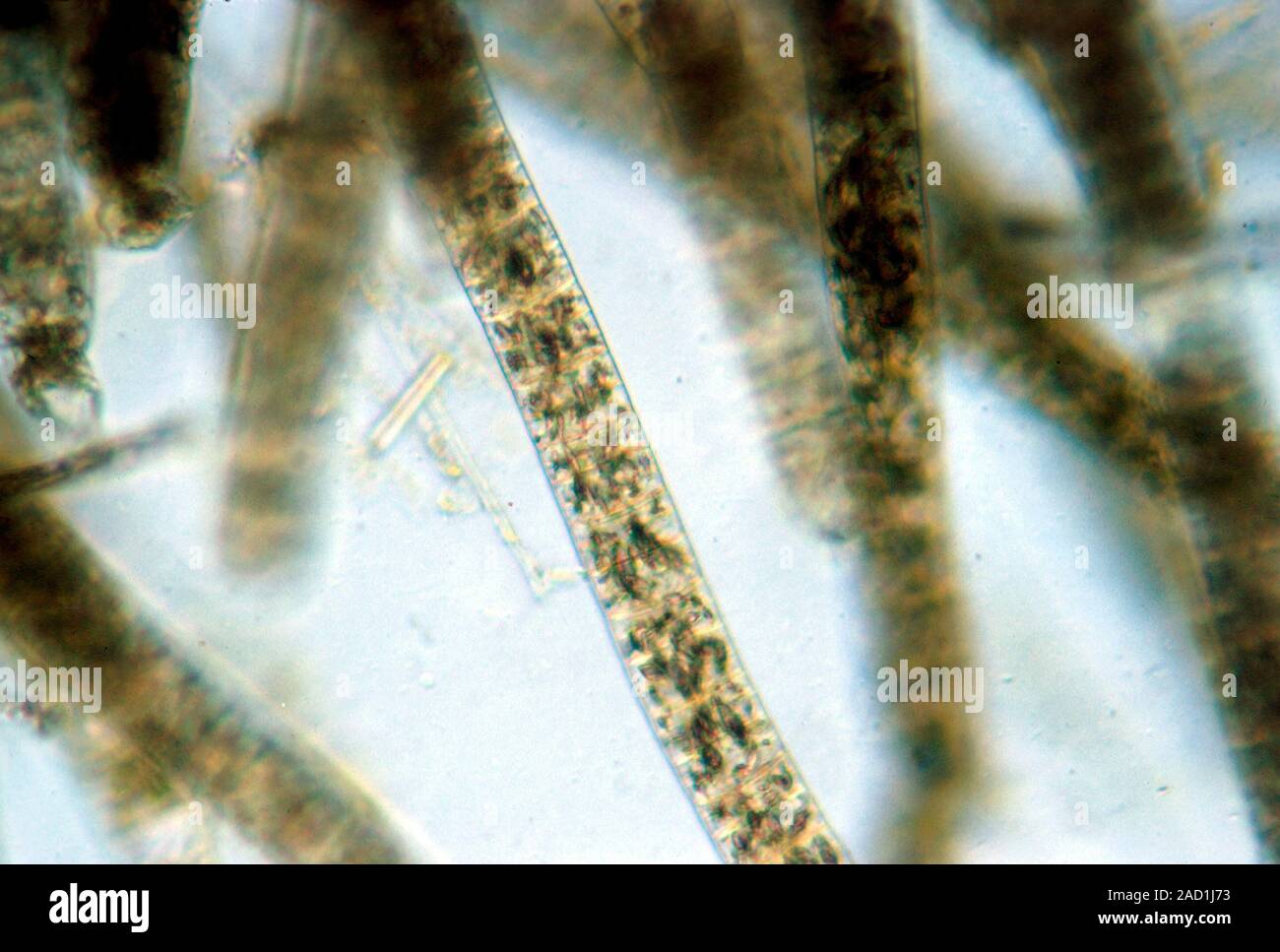 Trichodesmium cyanobacteria, light micrograph. Also known as cyanophyta ...