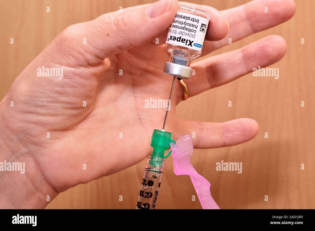 Dupuytren's contracture treatment. Syringe of collagenase being ...