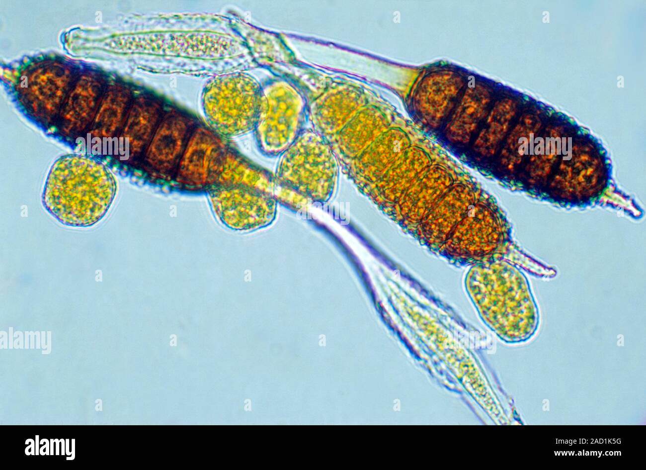 Rose spot fungus spores. Light micrograph of a section through spores ...