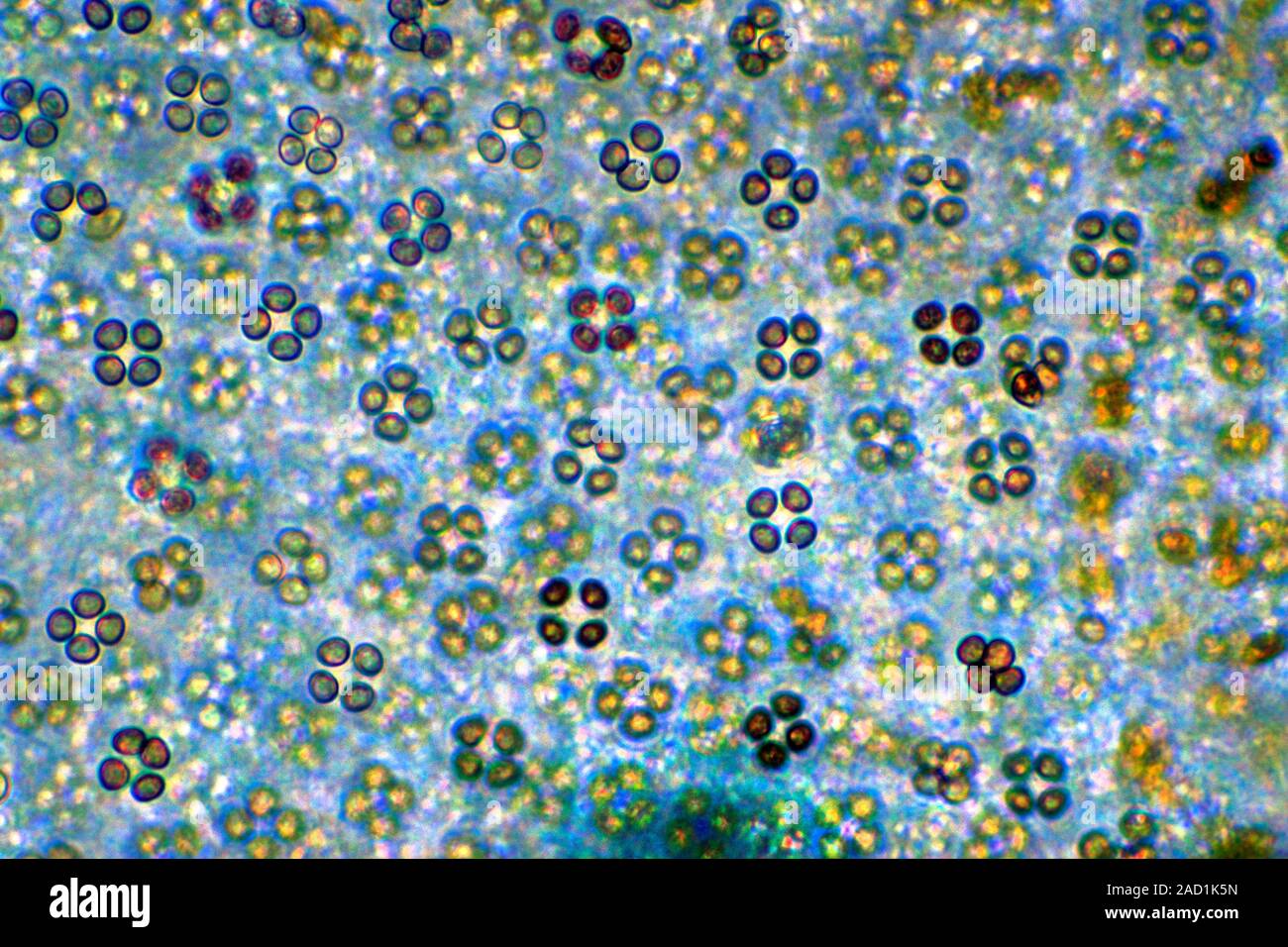 Mushroom spores. Light micrograph of a section through spores on the ...