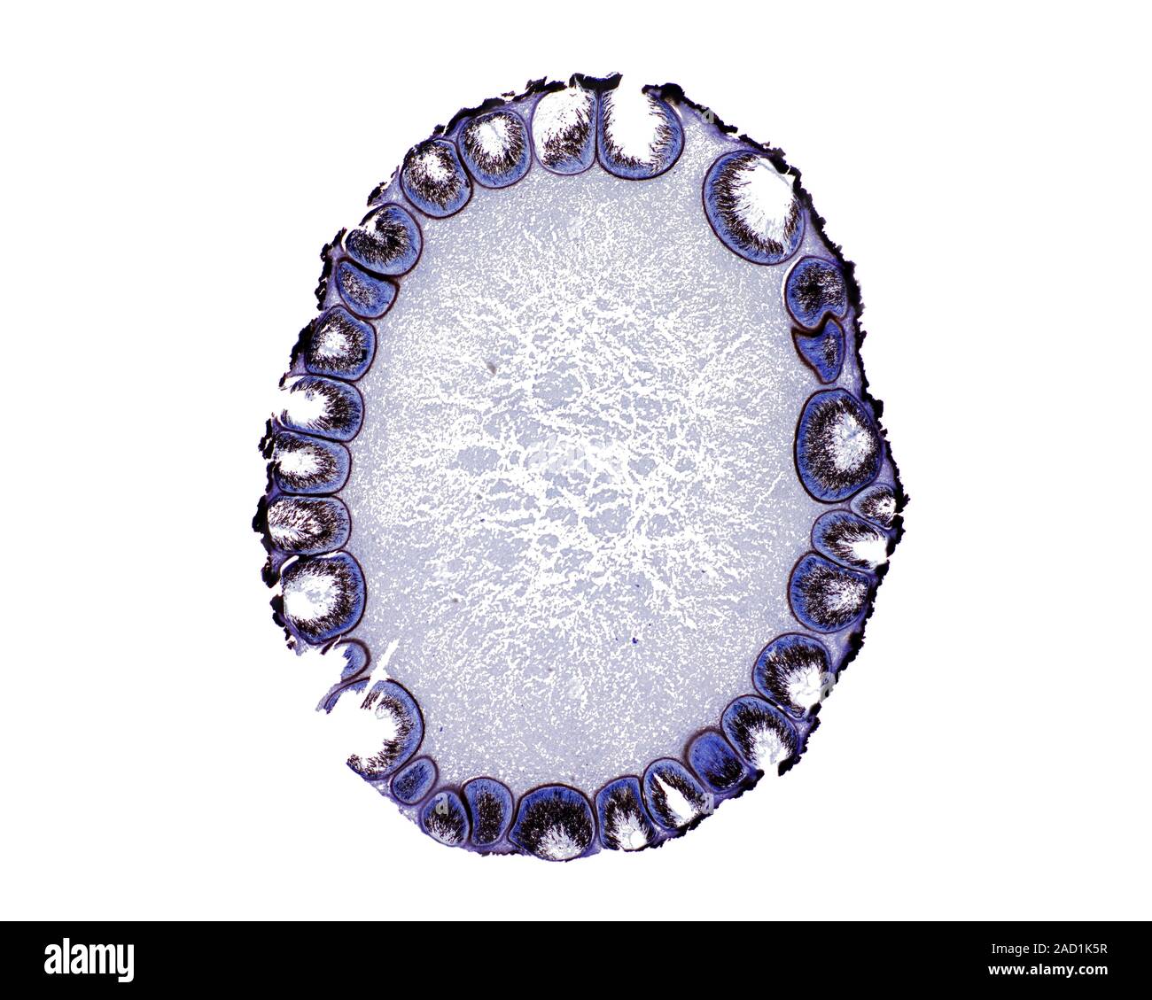 Mushroom (Hypoxylon sp.). Light micrograph of a section through the ...