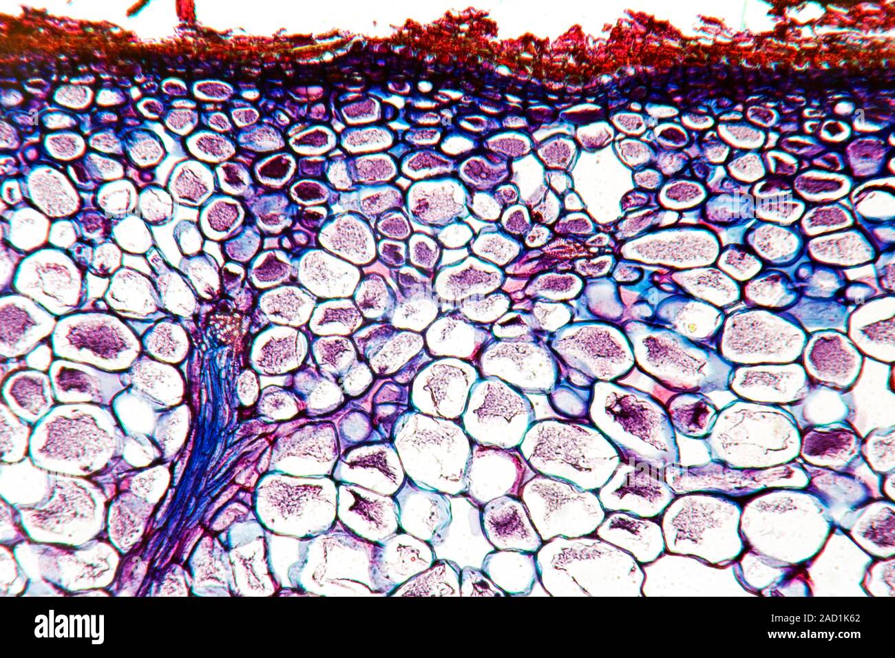 Pear tree infected with spot fungus. Light micrograph of tissue from a ...
