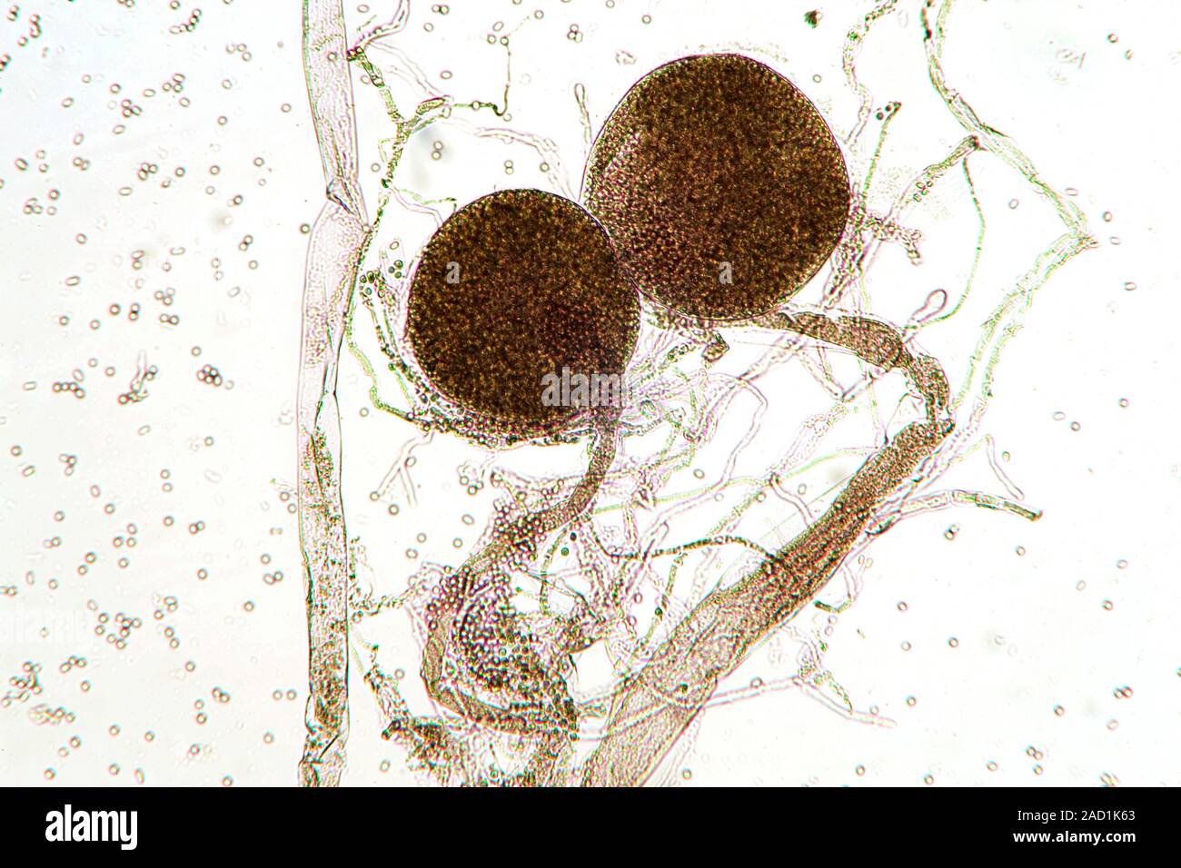 Aspergillus fungus. Light micrograph of a section through hyphae ...