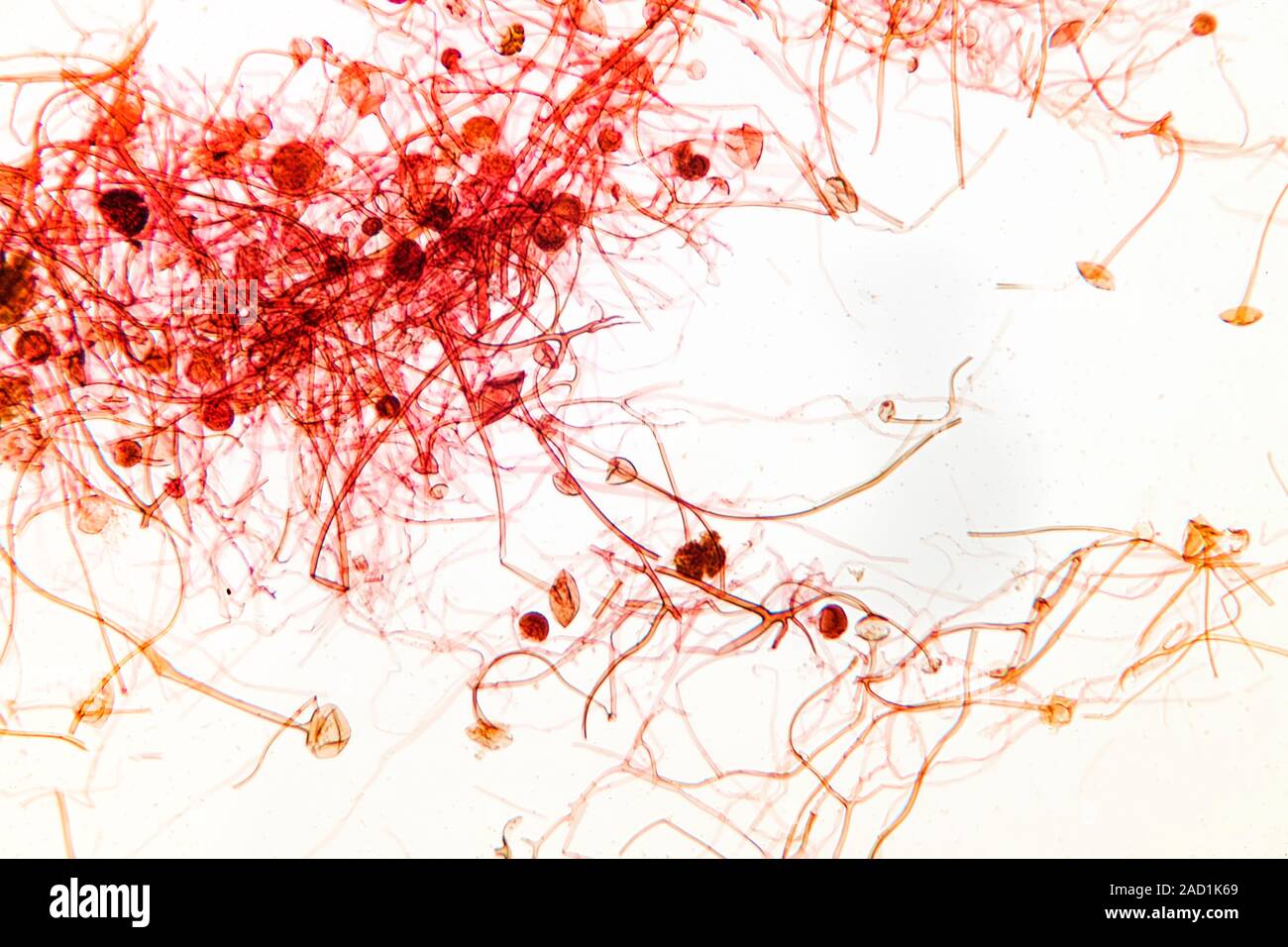 Rhizopus fungus. Light micrograph of a section through hyphae (thread ...