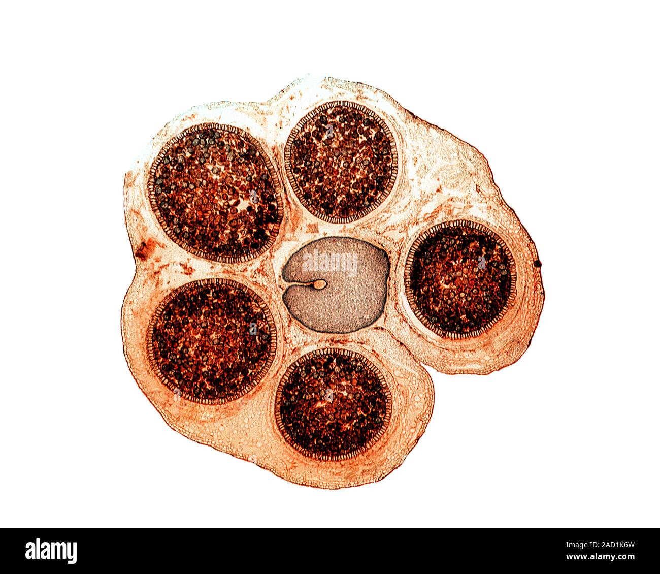 Liverwort sporangium. Light micrograph of a section through a ...