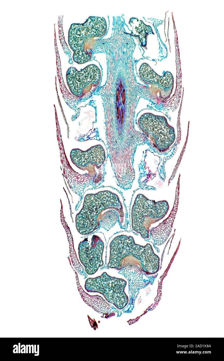 Clubmoss (Lycopodium clavatum) strobilus. Light micrograph of a section ...