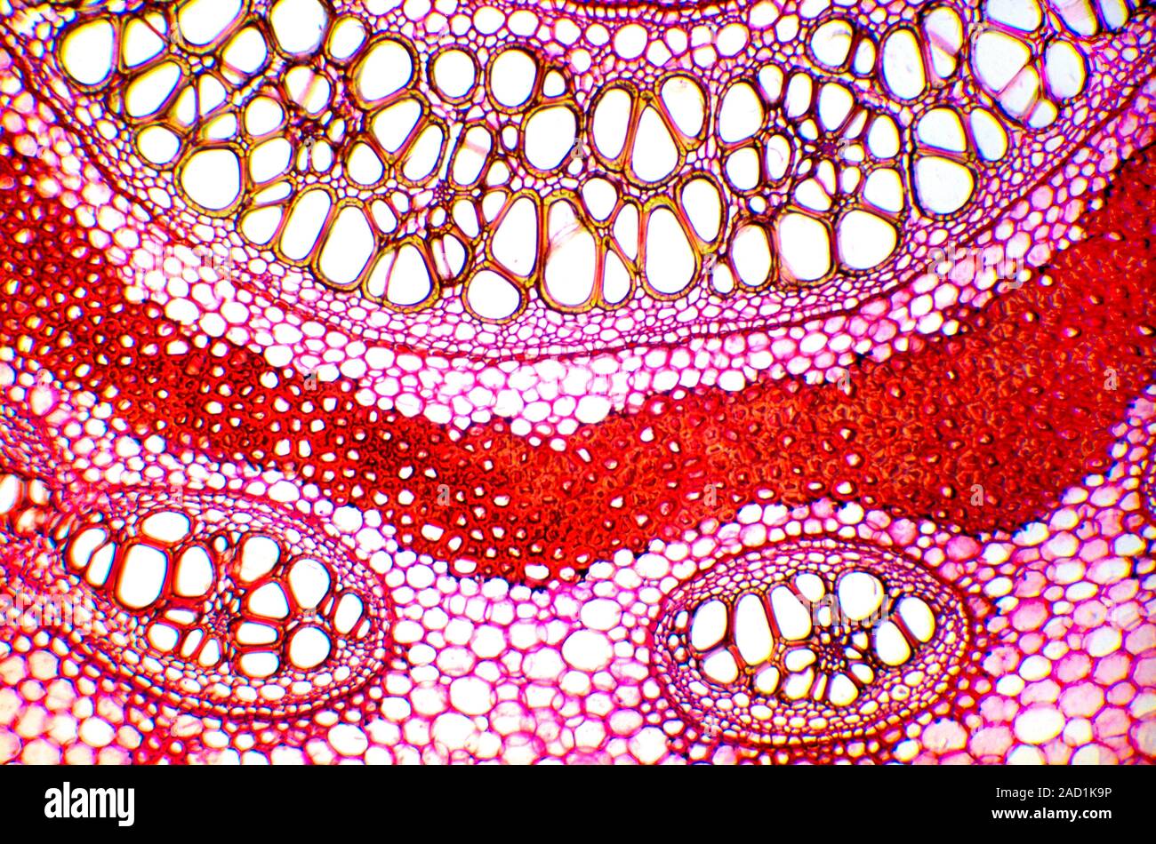 Fern (Pteridium aquilium) rhizome. Light micrograph of a section ...