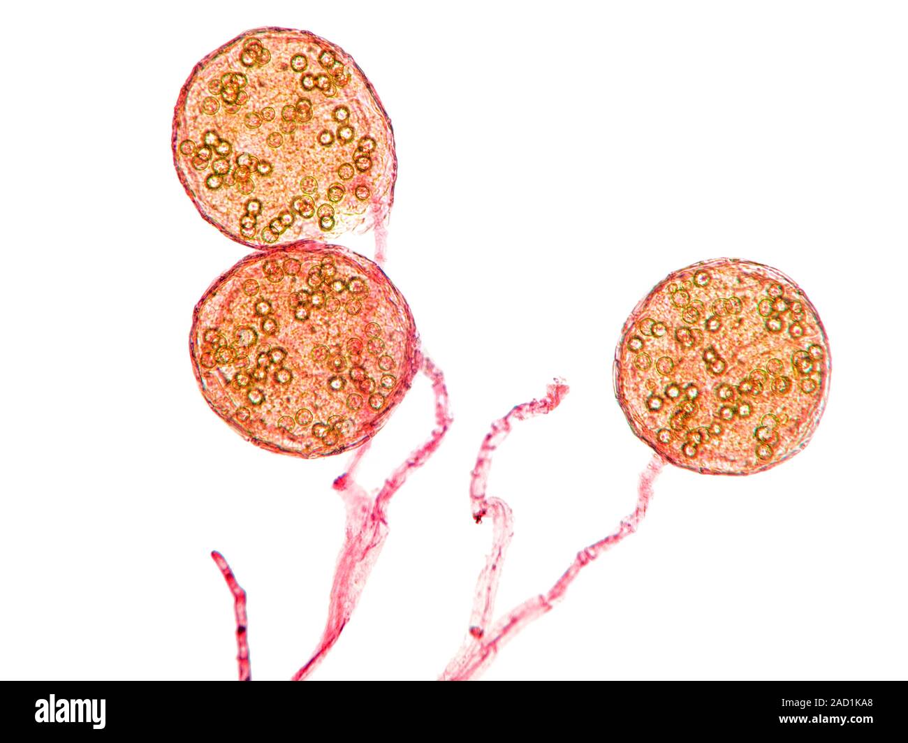 Fern (Azolla filiculoides) sporophytes. Light micrograph of a section ...